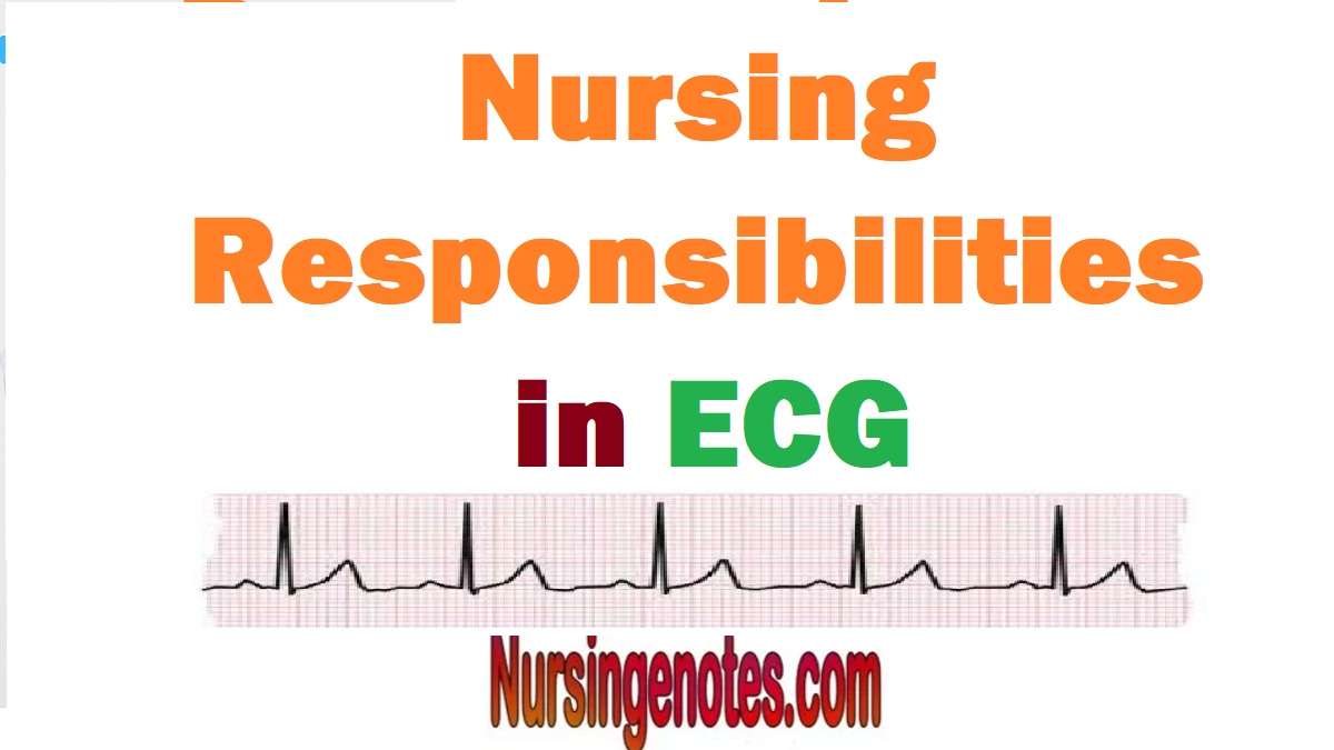 Nursing Responsibilities in ECG (Electrocardiography) - NursingNotes