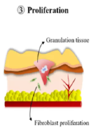 The Four Phases of Wound Healing: A Guide to the Wound Healing Process ...